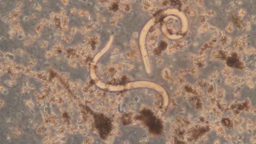 Year’s First Confirmed Case Of Rat Lungworm In West Hawaii
