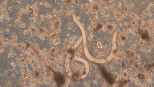 Two More Rat Lungworm Cases Confirmed On Hawai‘i Island