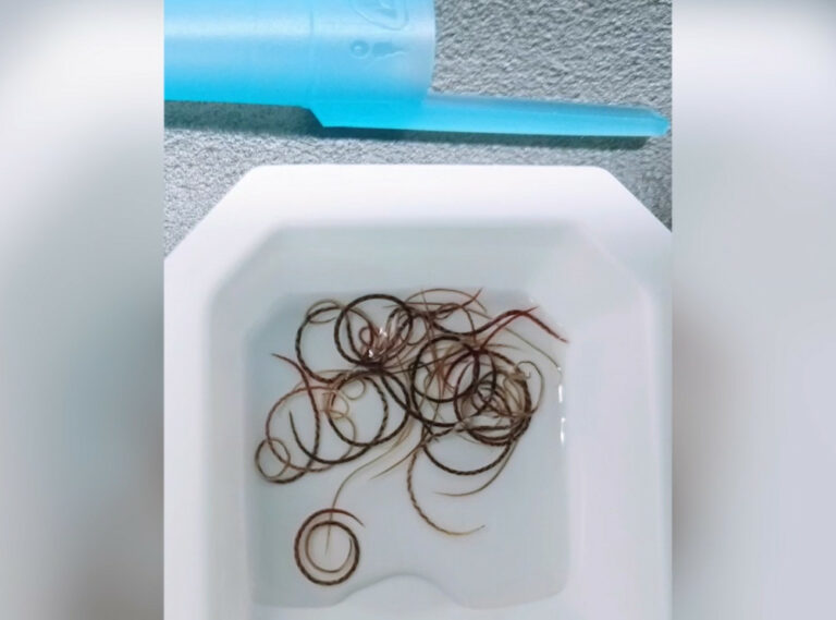 Slime From “Stressed” Snails, Slugs Can Spread Rat Lungworm